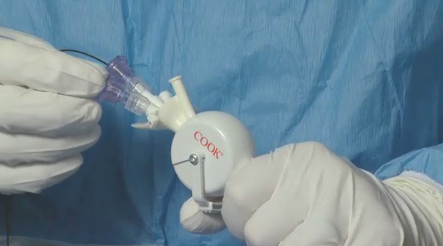 Cook Medical Launches Flexor® Vue™ Deflecting Endoscopic System ...