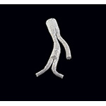 GORE® EXCLUDER® Iliac Branch Endoprosthesis Gains FDA Approval