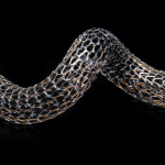 GORE® TIGRIS® Vascular Stent Gains FDA Approval for Treatment of ...