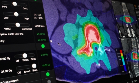 Brainlab announces FDA clearance for two new indication-specific ...