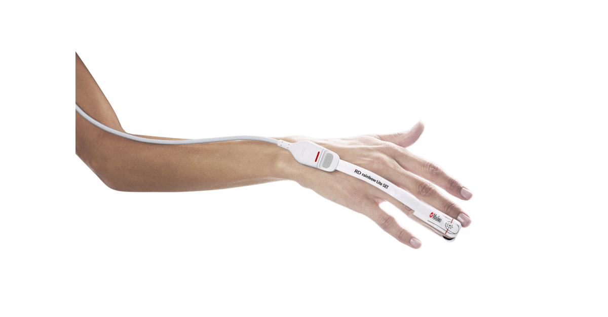 Masimo宣布氧储备指数™ rainbow Lite传感器获得CE标记并开始发售 | Business Wire