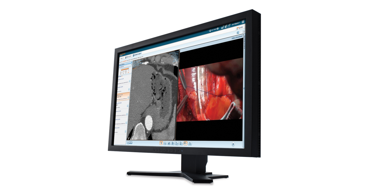 Award-Winning Healthcare System Installs Carestream’s Clinical ...