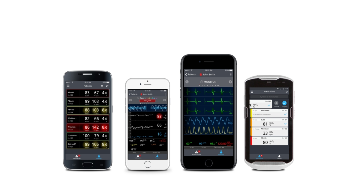 Masimo Announces Replica™ | Business Wire
