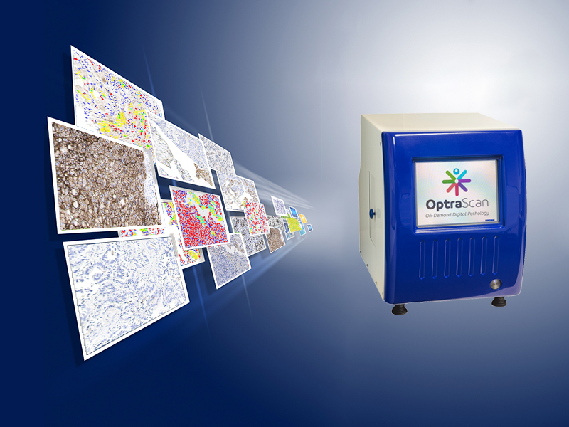 OptraSCAN Digital Pathology to Present PD-L1 Pathology AI Tool at AACR ...