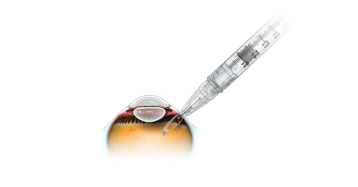 Genentech Unveils Positive Phase II Results for the First-Ever Eye ...