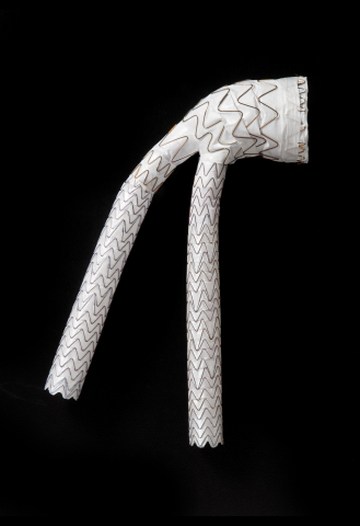 First Patient in Europe Receives Implant of GORE® EXCLUDER® Conformable ...