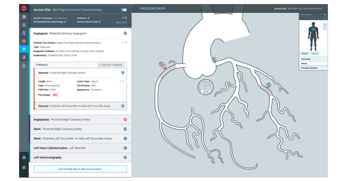 ZHealth Launches New Cardiovascular Software That Improves Both ...