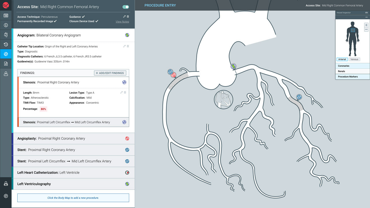 ZHealth Launches New Cardiovascular Software That Improves Both ...