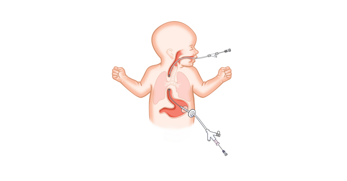 Cook Medical’s Flourish™ is Now Available | Business Wire