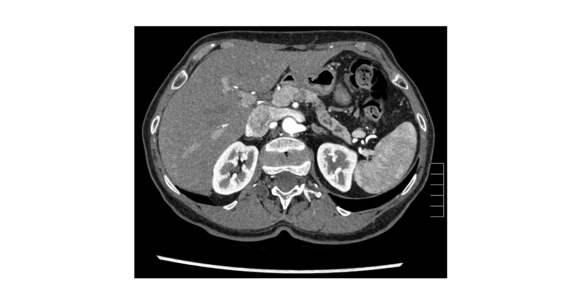 Canon Medical Forges New Ground with Deep Convolutional Neural Network ...