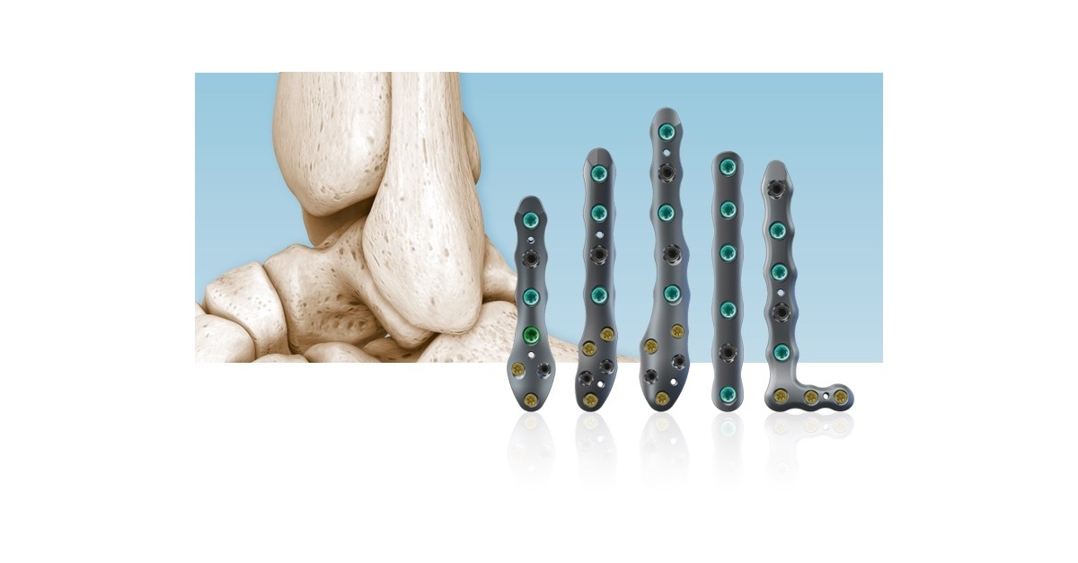 In2Bones Announces the Commercial Market Release of the CoLink® Afx ...