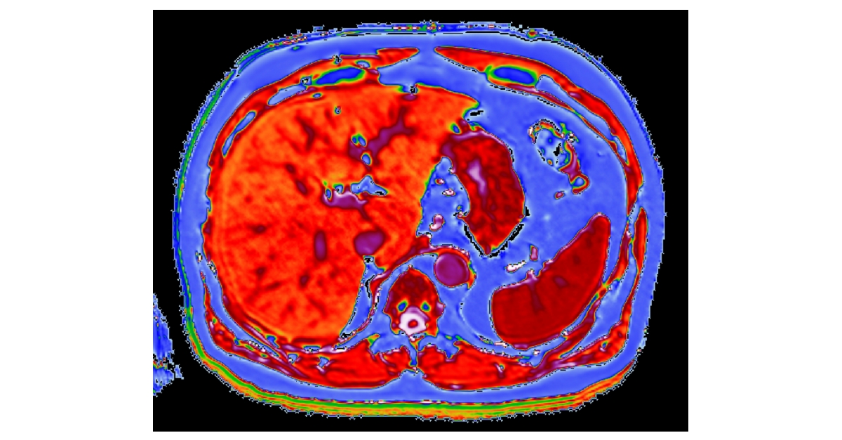 Perspectum Diagnostics Named in Top 100 Fastest Growing Companies ...