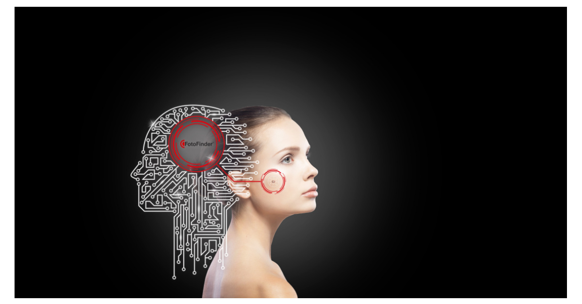 FotoFinder Systems: Artificial Intelligence Revolutionizes Skin Cancer ...