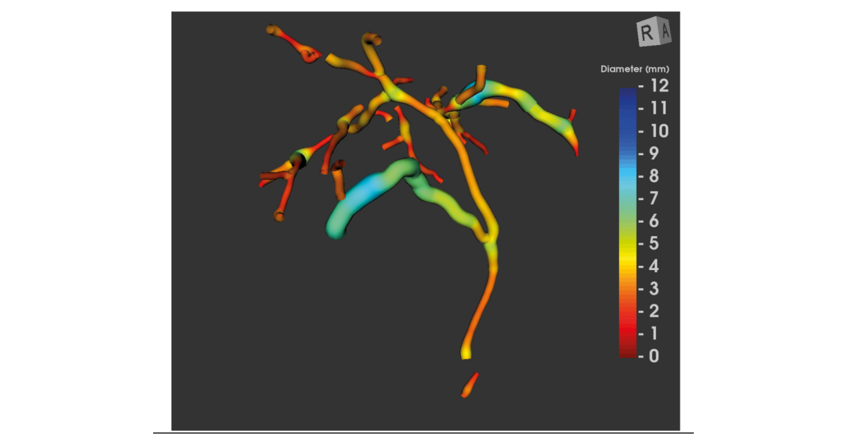 FDA Clearance for Perspectum’s Digital Biliary Tree Viewer, MRCP+ ...