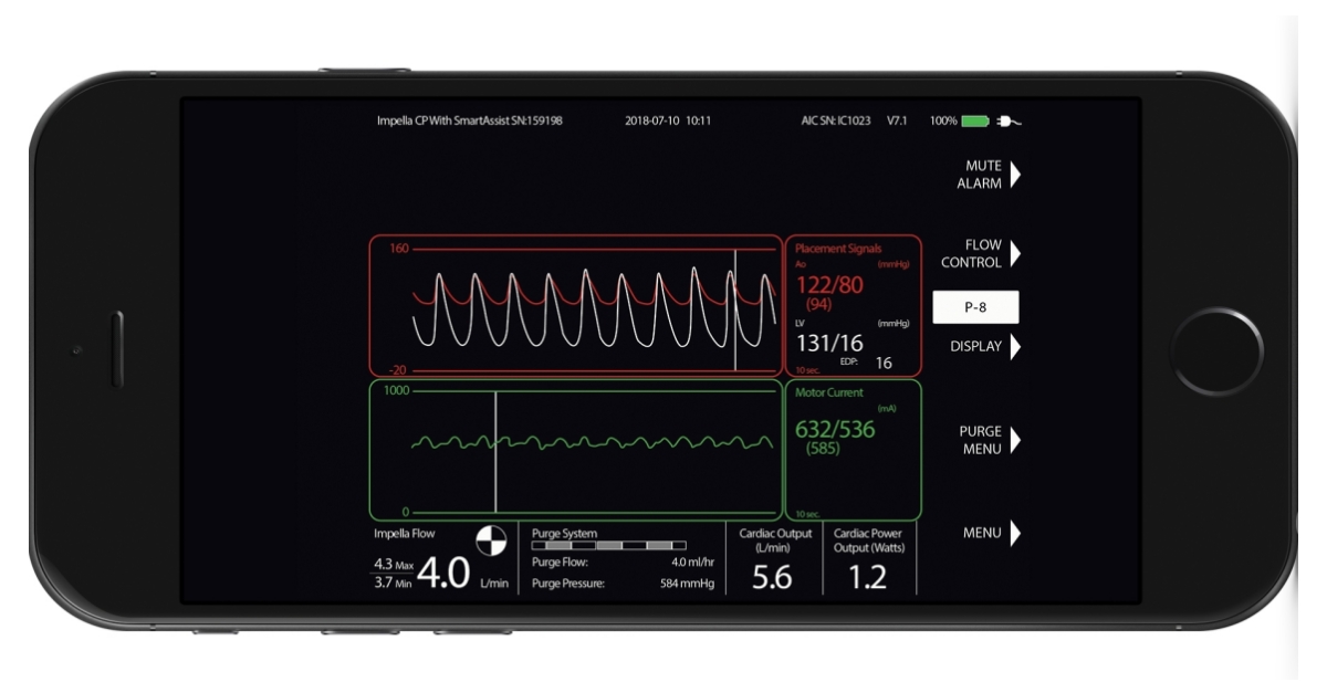 Impella Connect erreicht behördlichen Meilenstein | Business Wire