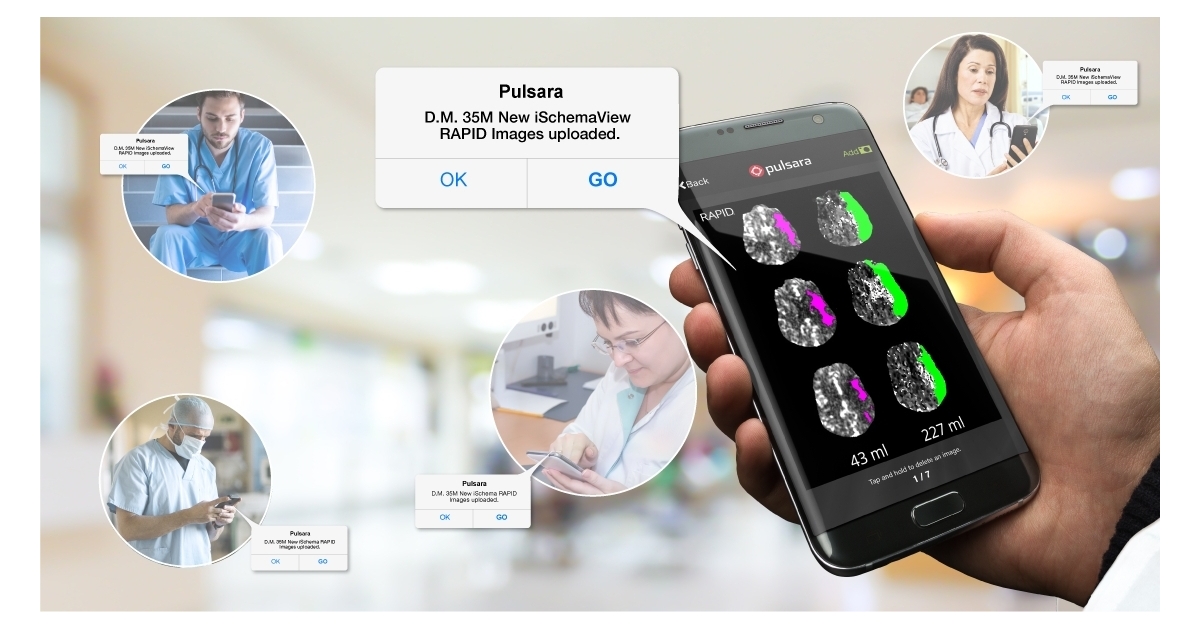 Pulsara and iSchemaView Unveil New RAPID Integration | Business Wire