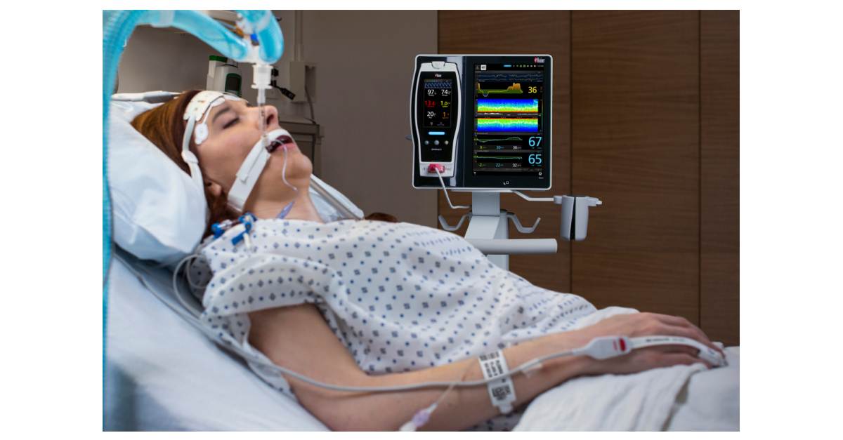 新病例系列研究心脏手术期间联合运用Masimo SedLine®脑功能监护仪与O3®局部氧饱和度仪 | Business Wire