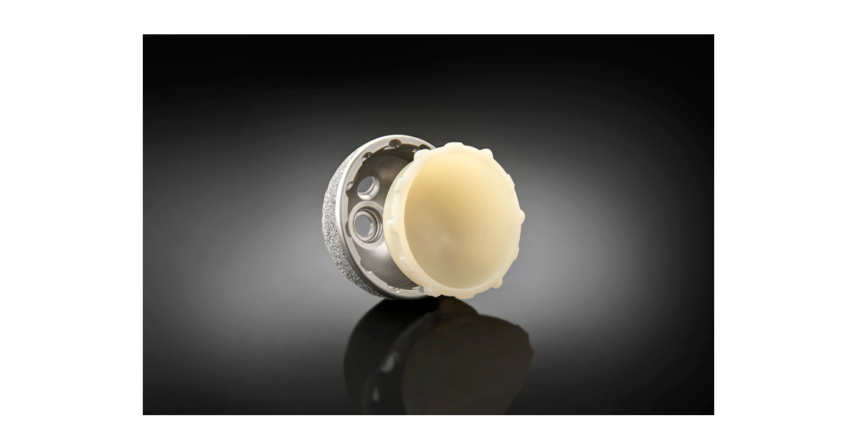 Exactech to Expand Hip Replacement System with New Acetabular Implant ...