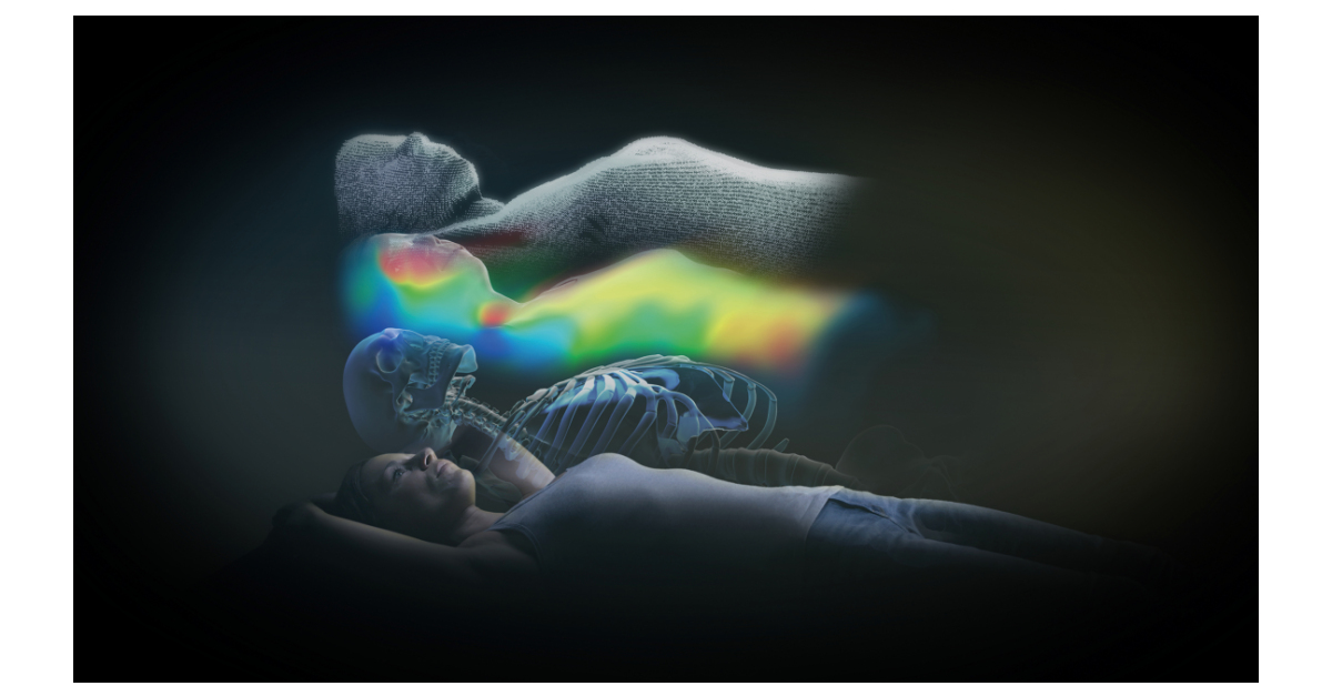 Next Generation ExacTrac Broadens Clinical Workflows | Business Wire