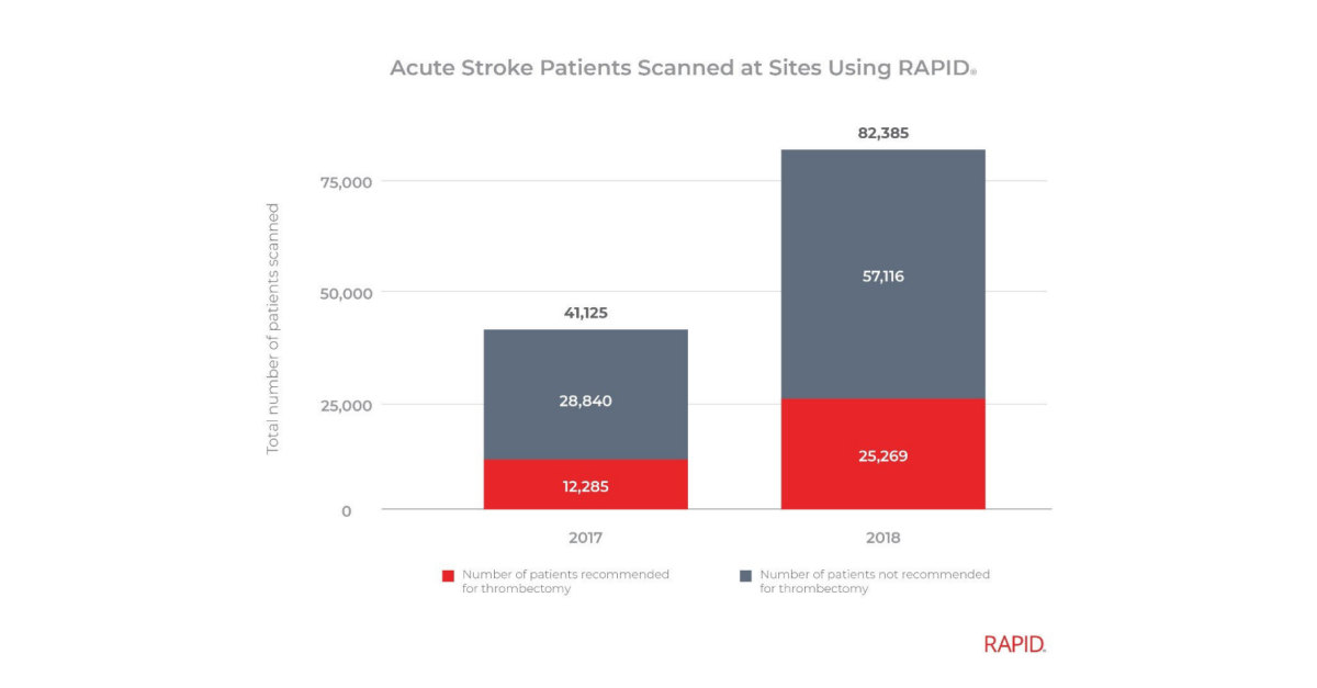 Data Suggests New Guidelines in Stroke Care Have Led to Record Numbers ...