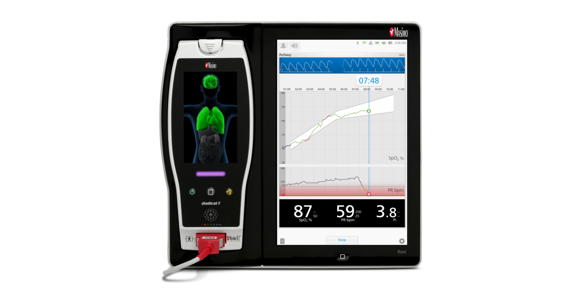 Masimo Announces Pathway™, a Newborn Oxygenation Visualization Mode for ...