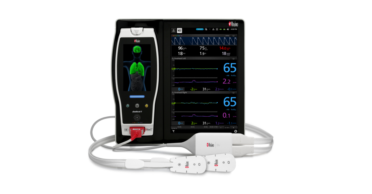 Masimo Announces Development of Delta cHb, HHb, and O2Hb Indices for O3 ...
