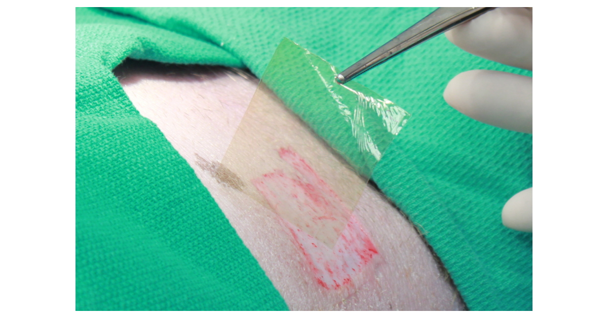 Imbed Awarded $1.5 Million NIH Grant to Fight Biofilms in Wounds ...