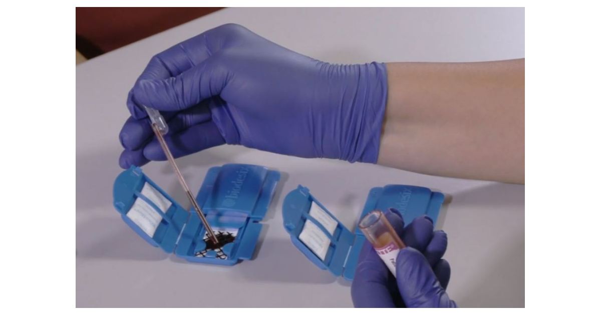 Biodesix Secures U.S. Patent for Proprietary Blood Specimen Collection ...