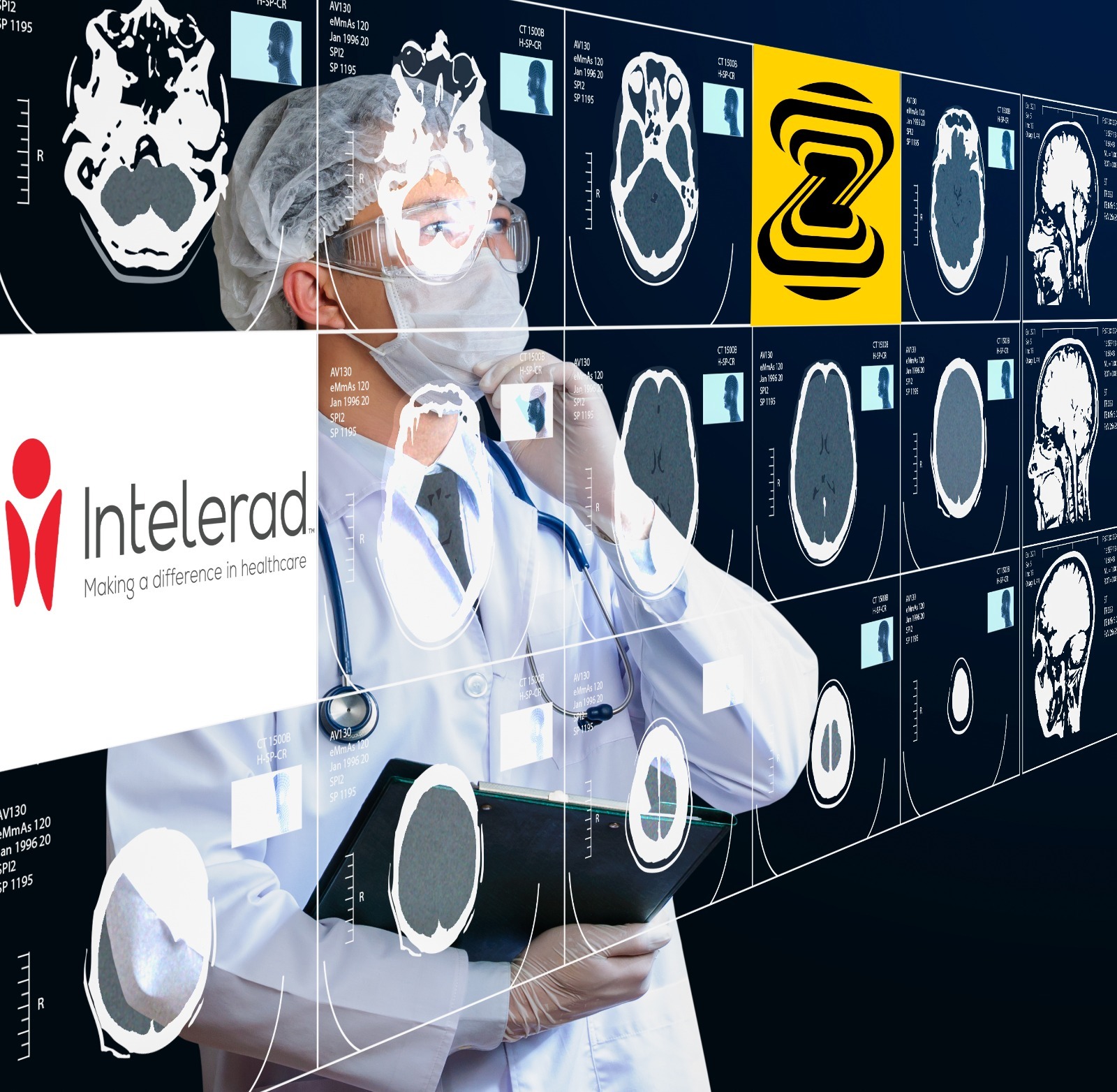 Intelerad and Zebra Medical Vision Join Forces to Accelerate AI ...