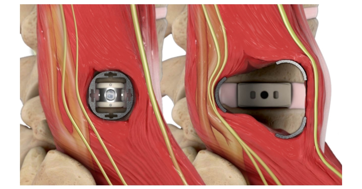 Unique Study Nominated for Best Paper at SMISS by Providing Rare ...