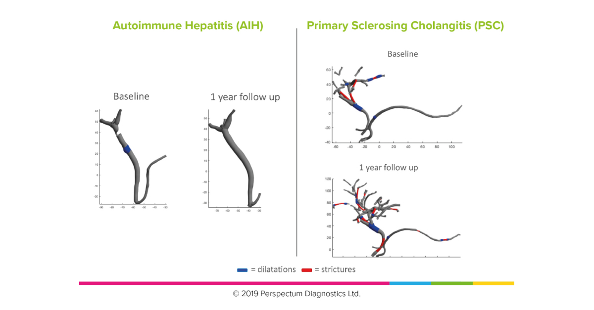 Seeing and Measuring Hepatobiliary Disease Using Artificial ...