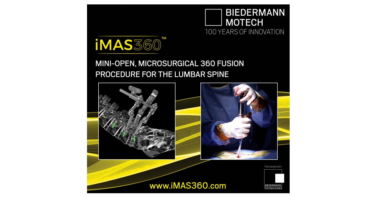 Biedermann Motech Announces Publication of Initial Clinical Outcome ...