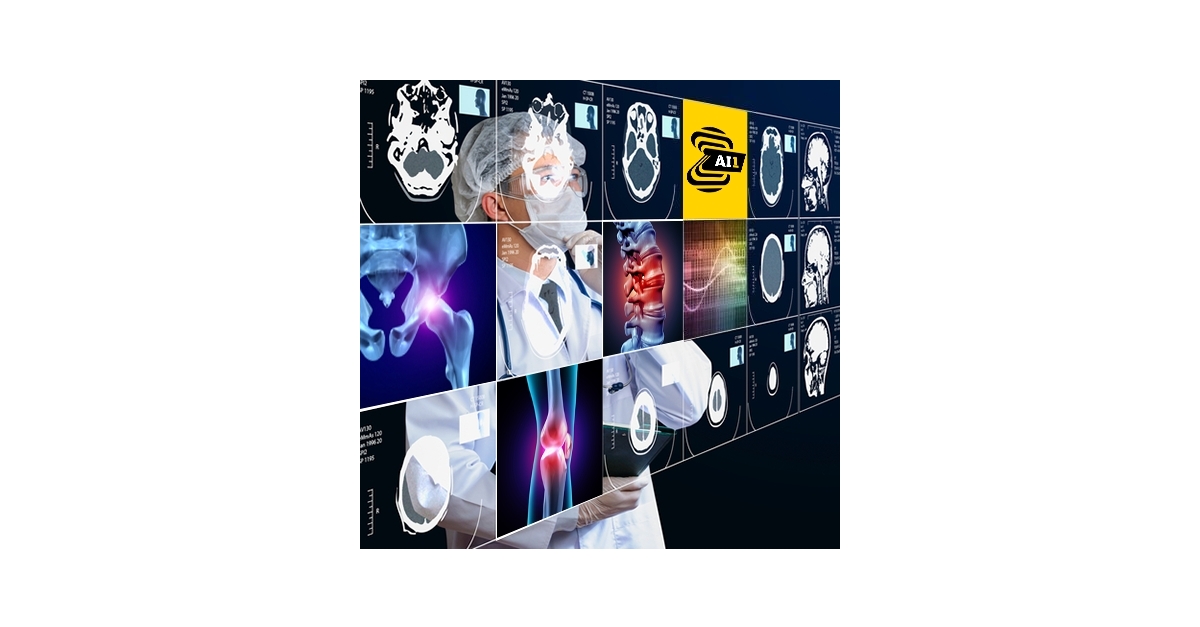 Zebra Medical Vision Announces Agreement With DePuy Synthes to Deploy ...