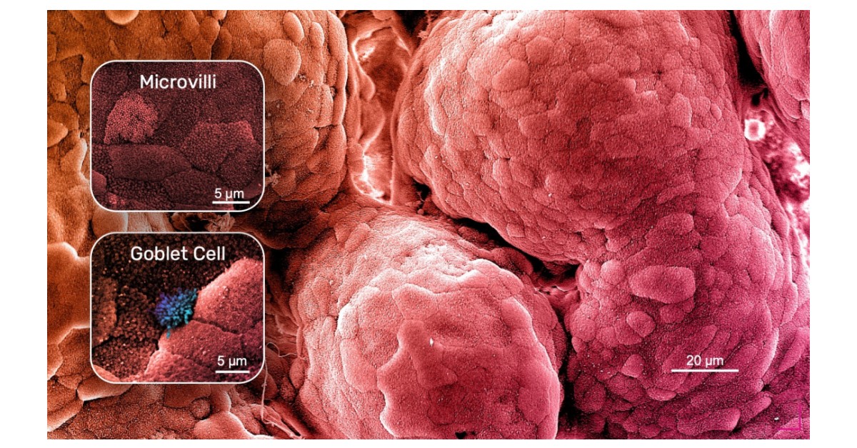 Emulate Publishes Results for Intestine-Chip Populated with Organoids ...