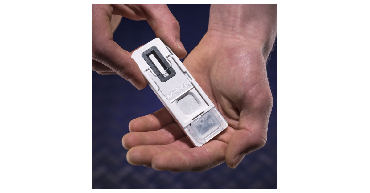 Fingerprint Diagnostics Test Could Deliver COVID-19 Testing Results in ...