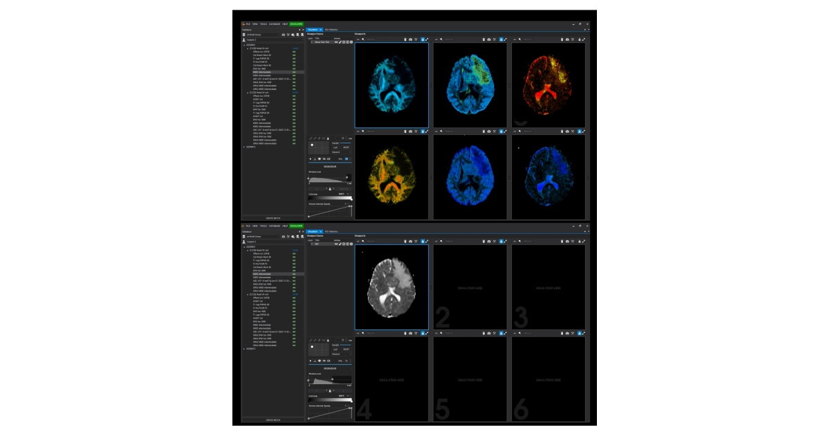 Random Walk Imaging Launches dVIEWR MRI Image Analysis and Workflow ...