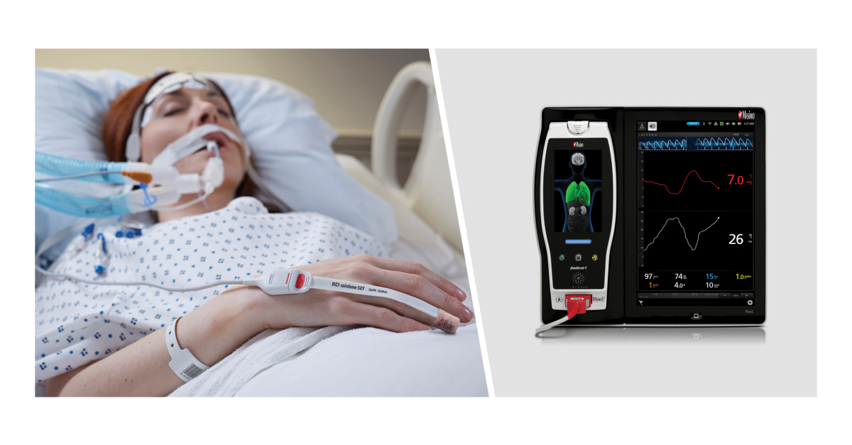 Masimo PVi® Receives FDA Clearance as an Indicator of Fluid ...