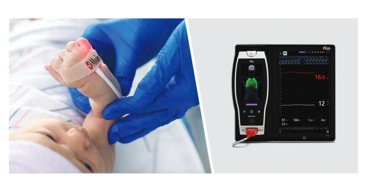 De nouvelles études examinent l'exactitude de la surveillance continue ...