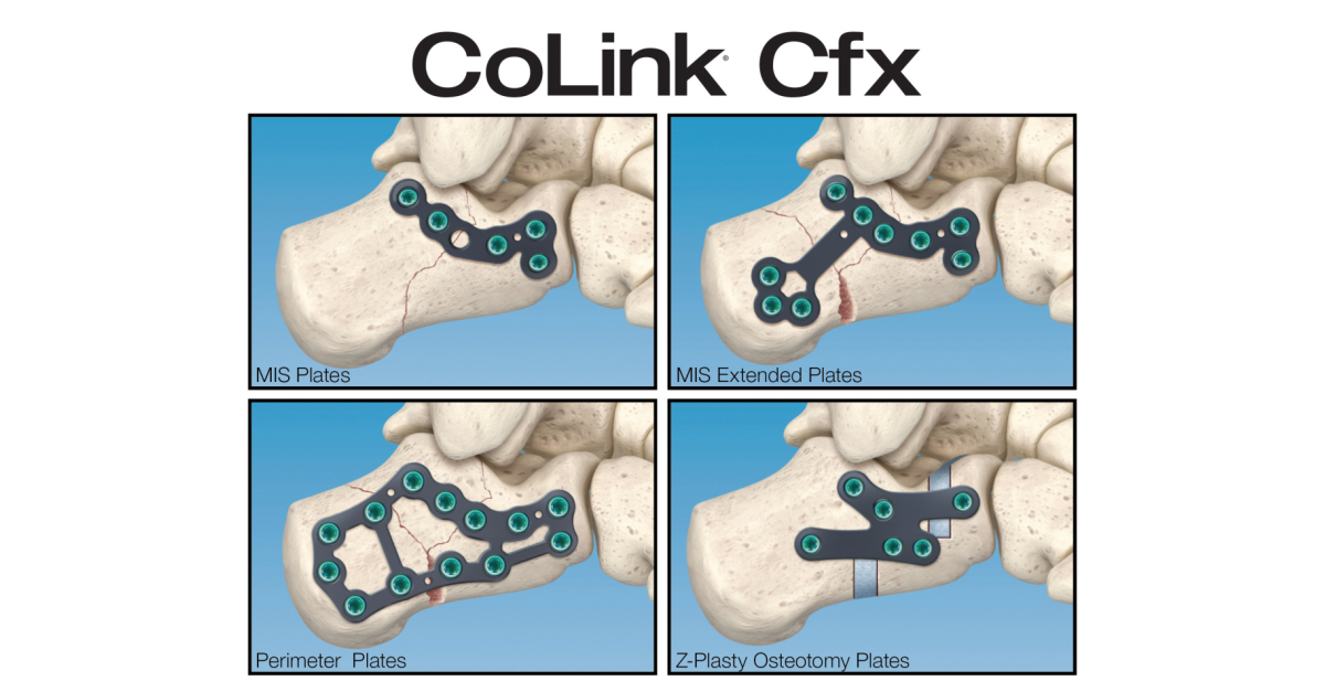 In2Bones Introduces CoLink® Cfx Calcaneal Fixation System | Business Wire