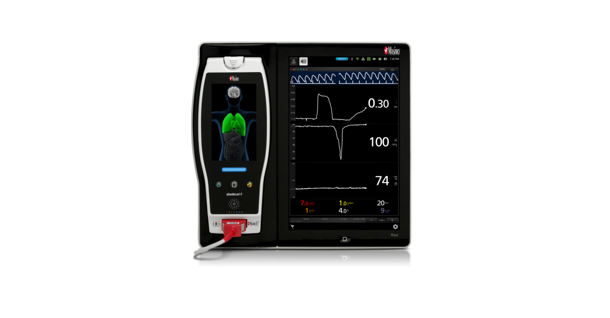 Researchers Use Masimo ORi™, Oxygen Reserve Index, to Predict the Need ...