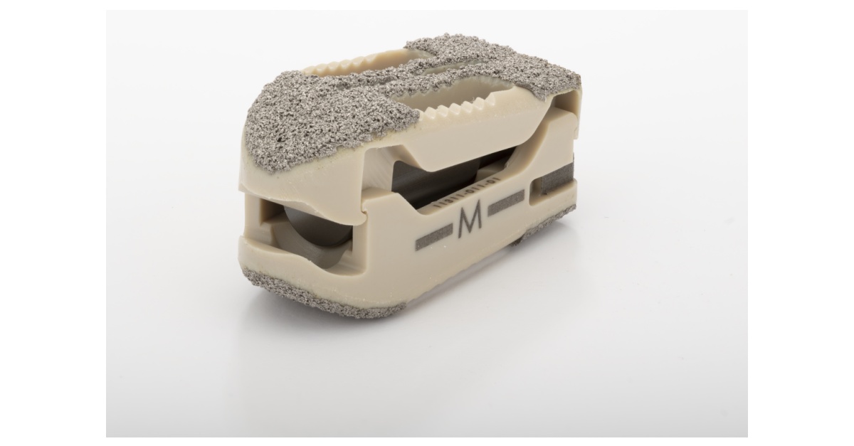 Spinal Elements® Announces the Expansion of its MIS Ultra™ Offering ...