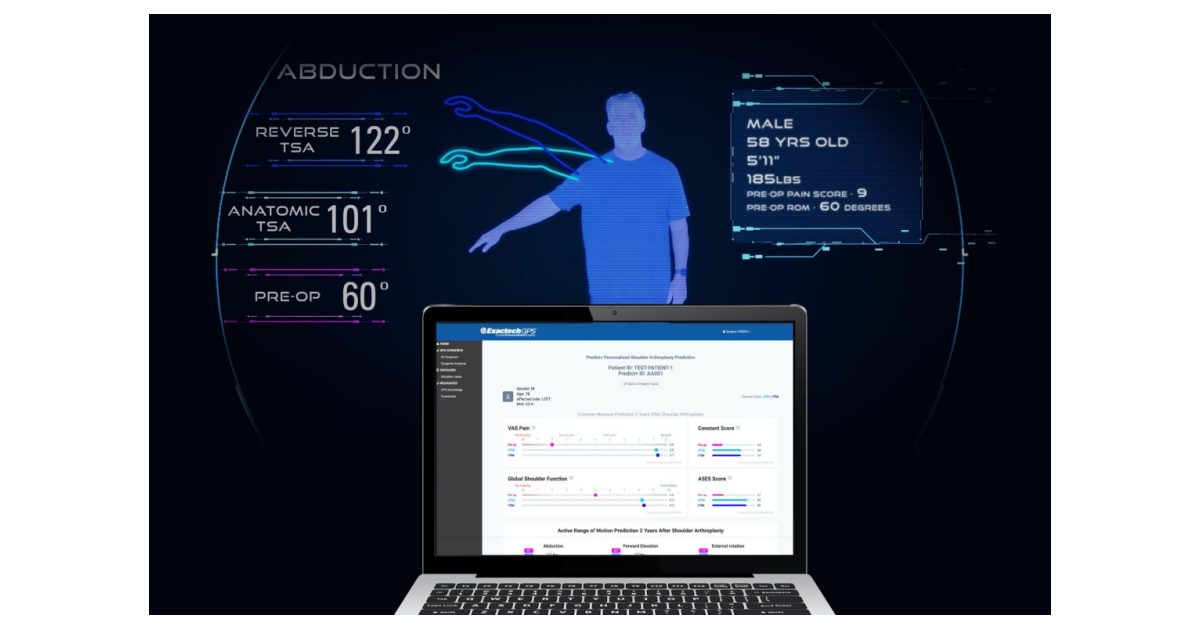 Exactech Launches Predict+™, First Machine Learning-Based Software that ...