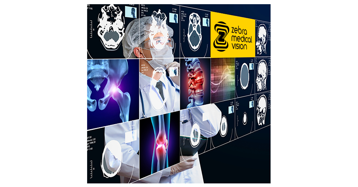 Zebra Medical Vision Secures a 7th FDA Clearance for Its Patented ...