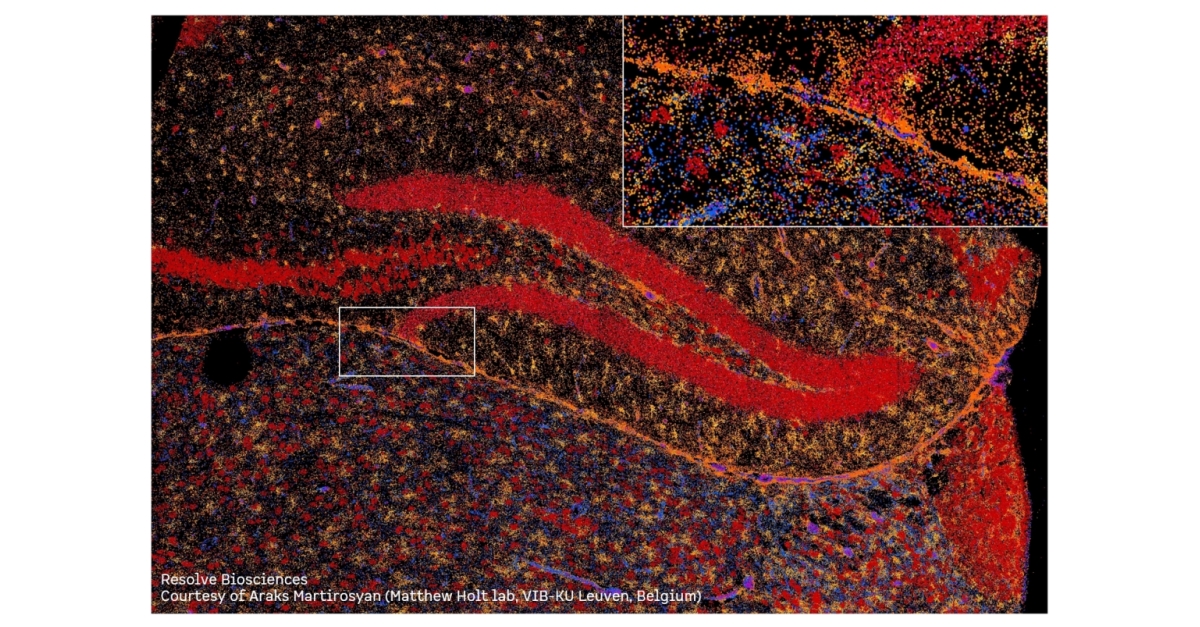 Resolve Biosciences Launches New Era in Single-Cell Spatial Analysis ...