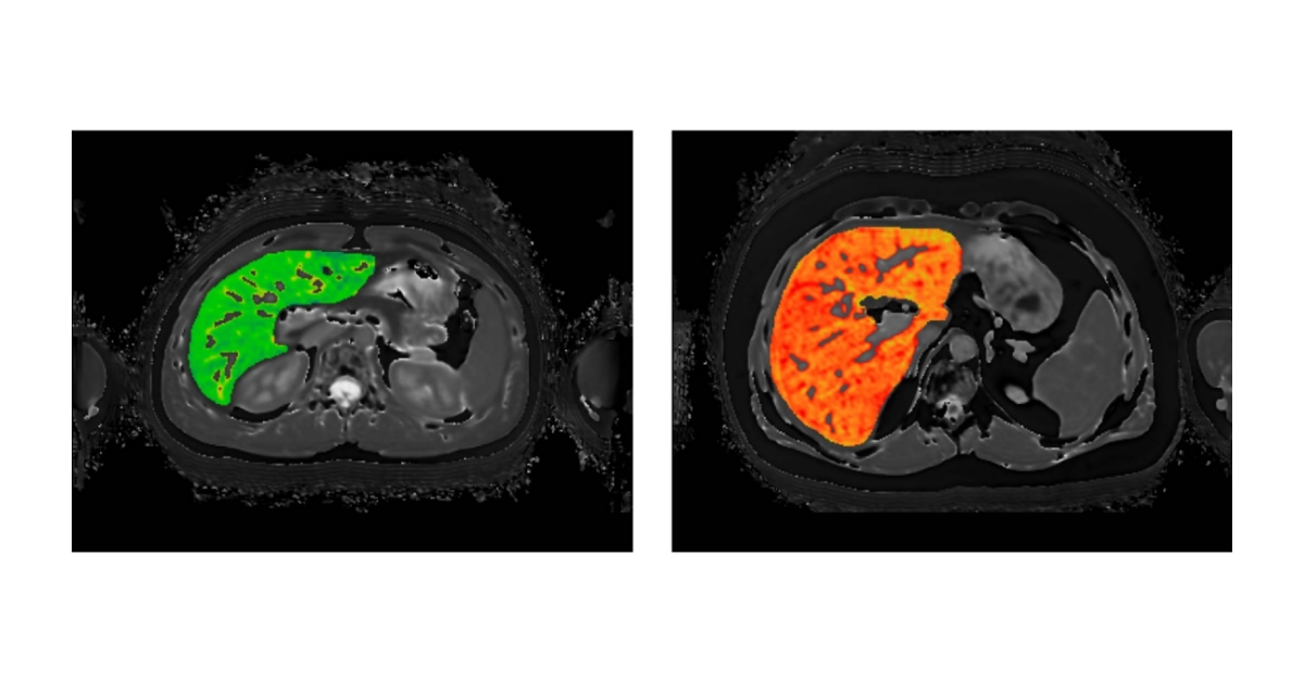 Perspectum Announces American Medical Association Issues Unique ...