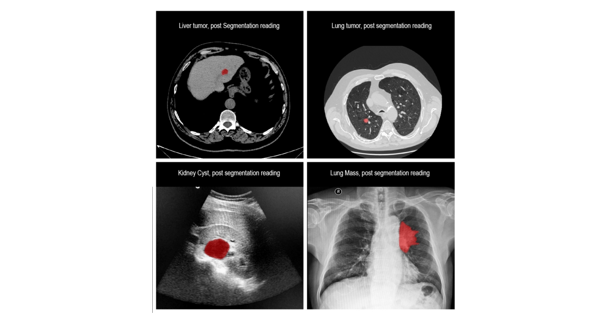 RSIP Vision Announces Versatile Medical Image Segmentation Tool ...