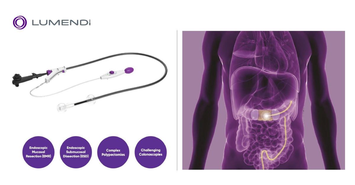 Lumendi Introduces EZ Glide Hydrophilic Coating for Its DiLumen ...