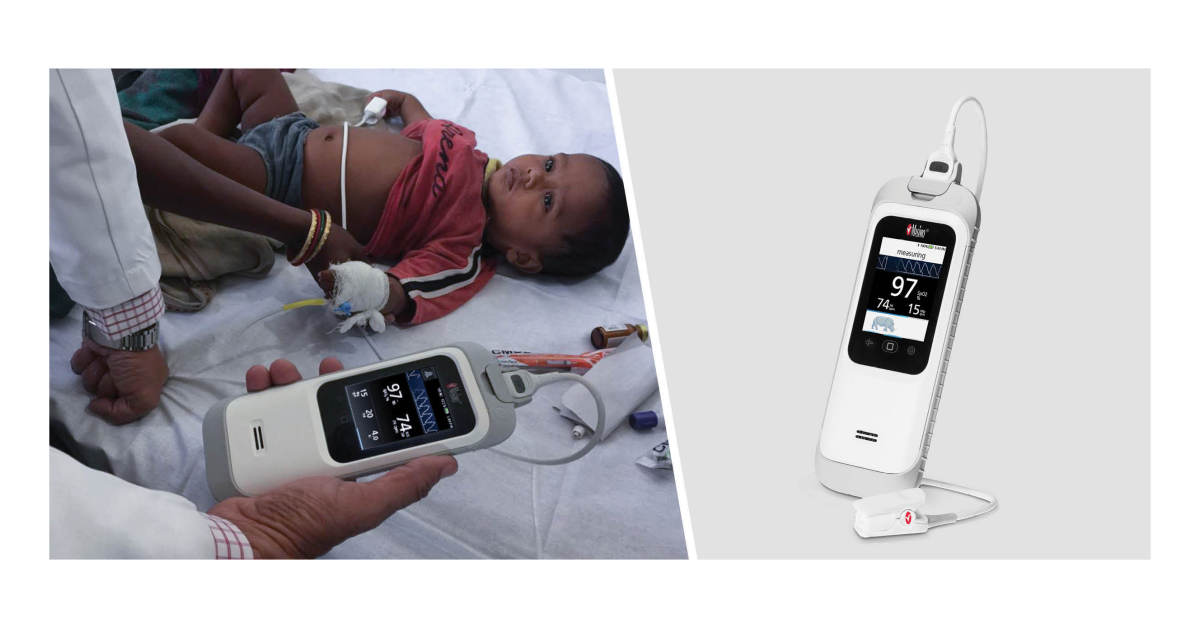 一項研究調查了採用Masimo Rad-G™搭配RRp®實現自動呼吸頻率測量的影響 | Business Wire