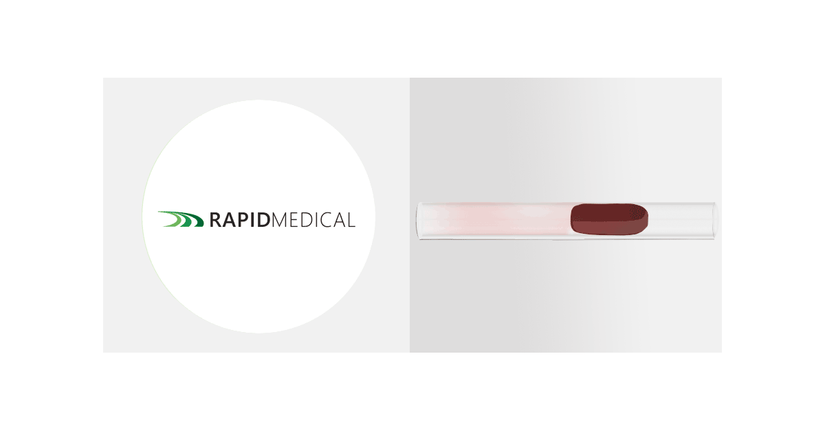 First US Ischemic Stroke Patients Treated with Rapid Medical’s Novel ...