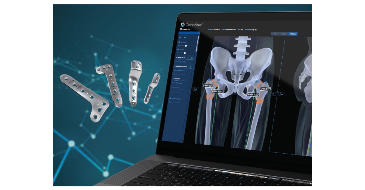 Orthofix Announces FDA Clearance of the OrthoNext Digital Platform for ...